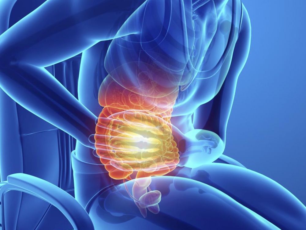 Le syndrome de l'intestin irritable (ou colopathie fonctionnelle ...